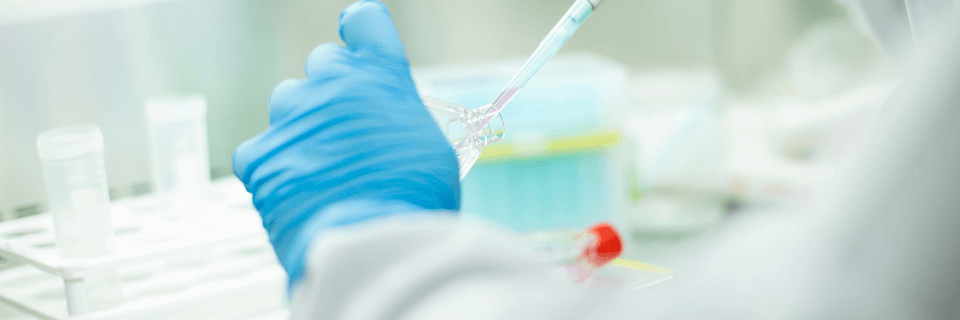 創傷治癒アッセイの方法・プロトコル(Scratch Wound Healing Assay) | TetraMedia Inc.